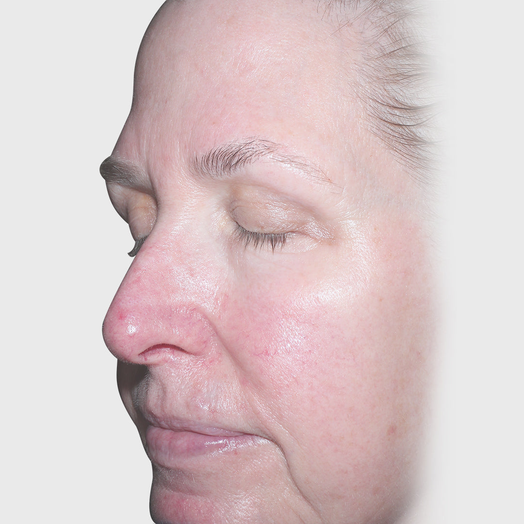 Elevai Enfinity™ Exosome Daily Serum – Elevai Skincare