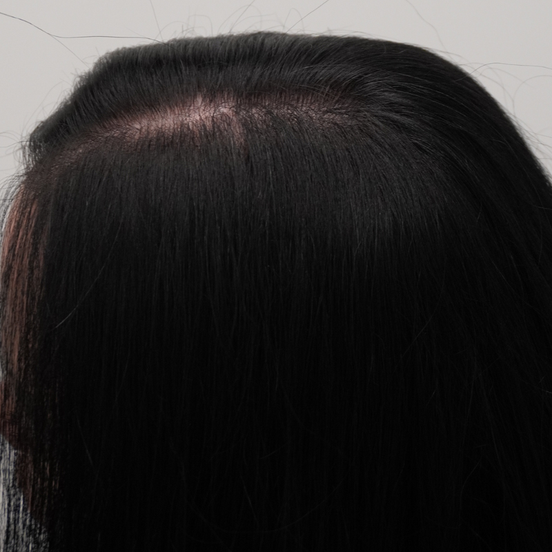 Elevai Root Renewal System™ | Exosome Regenerative Kit for Hair Loss – Elevai Skincare